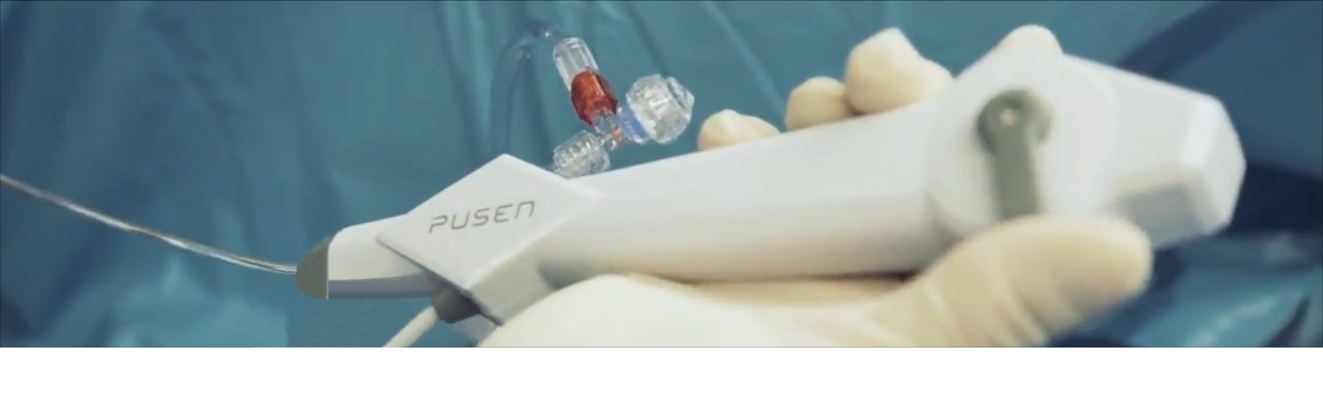 Pusen Ureteroskope – Vertrieb durch die URO-Rent GmbH